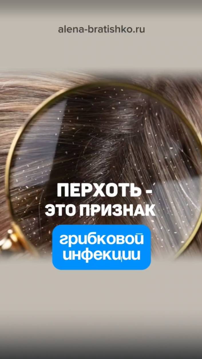 Перхоть - это признак грибковой инфекции в организме. Алена Братишко