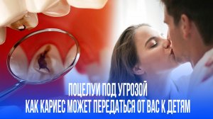 Поцелуй с последствиями: как кариес может стать нежелательным подарком для ваших близких