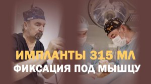 Увеличение груди имплантами 315 мл с дополнительной стабилизацией