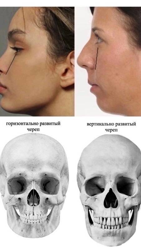 Сальто с элементами хирургии лица.Юмор.Смеха ради. #сезонконтентаRUTUBE
