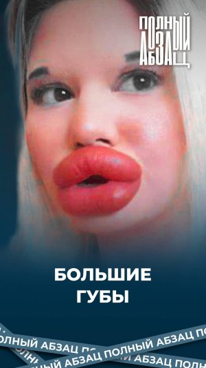 Женщина с самыми большими губами