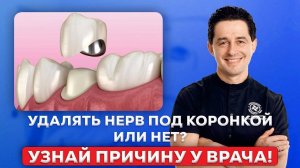 Удалять Нерв Под Коронку или Нет? Узнай Причину у Врача!