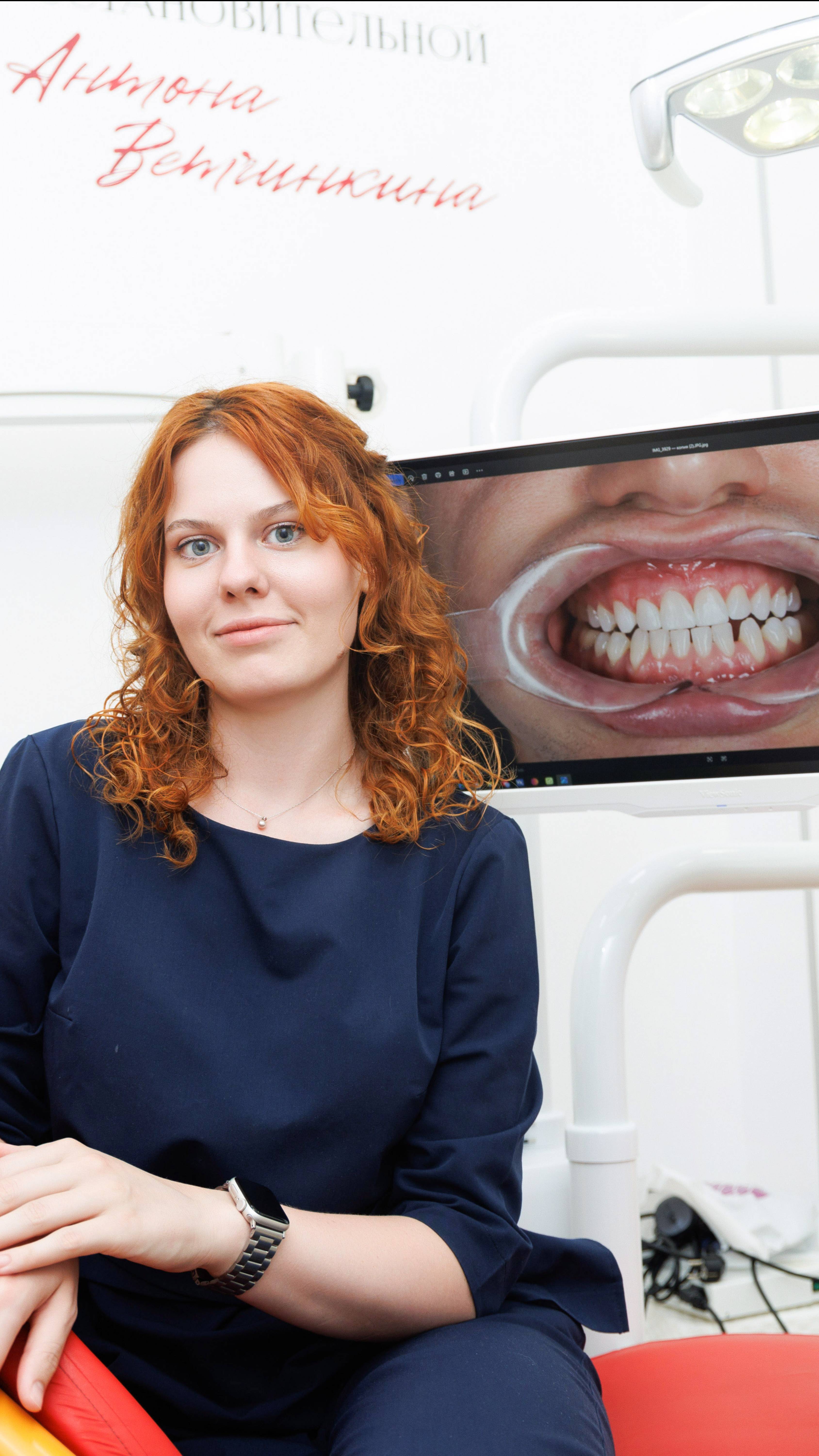 То, что вы не знаете об отбеливание зубов