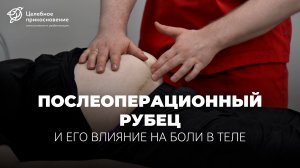 Послеоперационный рубец и его влияние на боли в теле | Целебное Прикосновение
