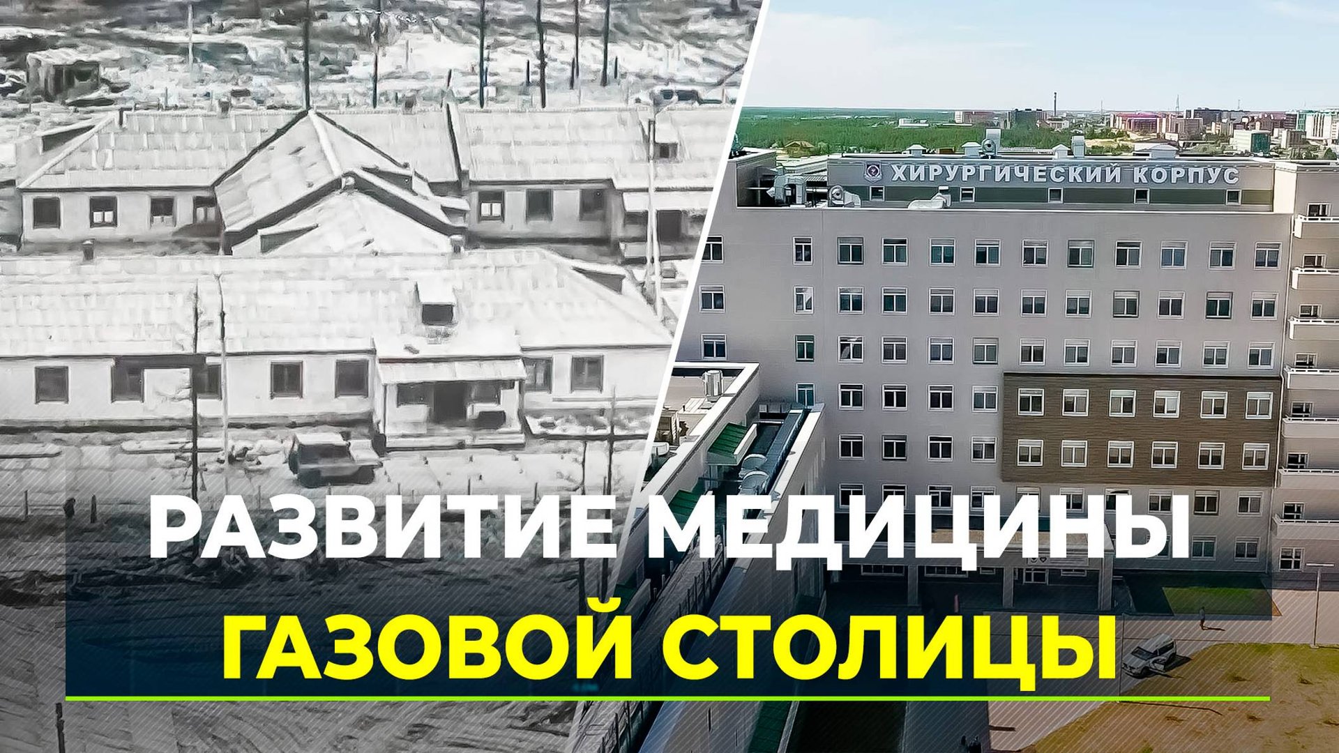 Новоуренгойская больница: от деревянных бараков к современным комплексам