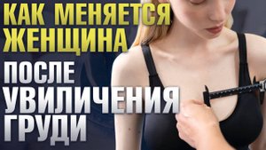 Маммопластика: как может измениться жизнь после пластики груди? Пластический хирург Сергей Свиридов