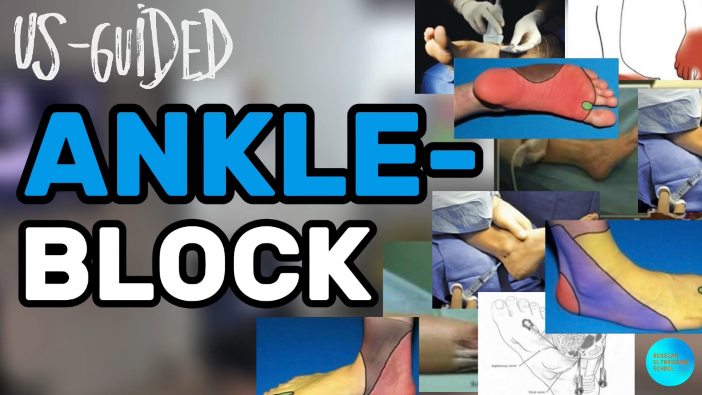 ВЫ ОСВОИТЕ ANKLE-BLOCK ВСЕГО ЗА 15 МИНУТ! #узи #anatomy #ultrasound #anaesthesia #anaesthesiology