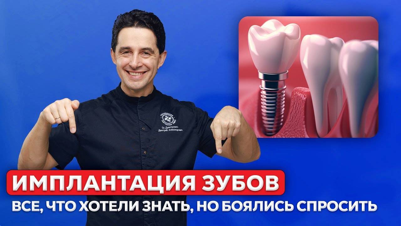 Топ 10 наиболее частых вопросов про имплантацию зубов. Все что вы хотели знать, но боялись спросить