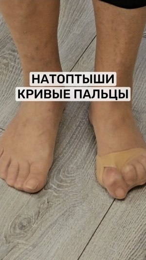 Подберём правильную стельку, уберём натоптыши, вернём пальчикам жизнь