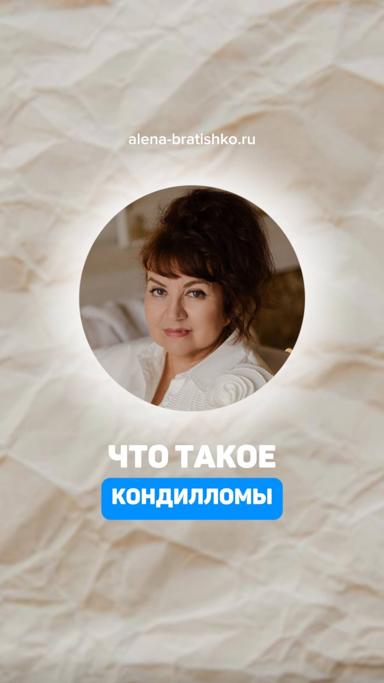 Кондилломы