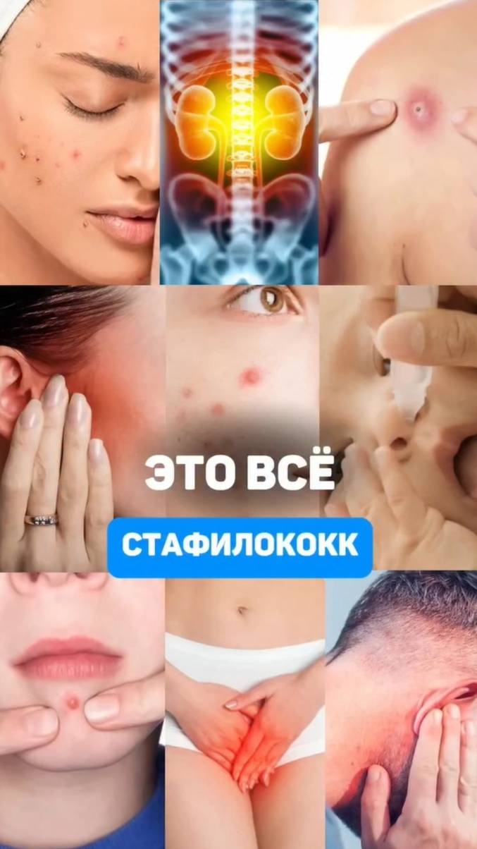 Причина этих болезней - стафилококк