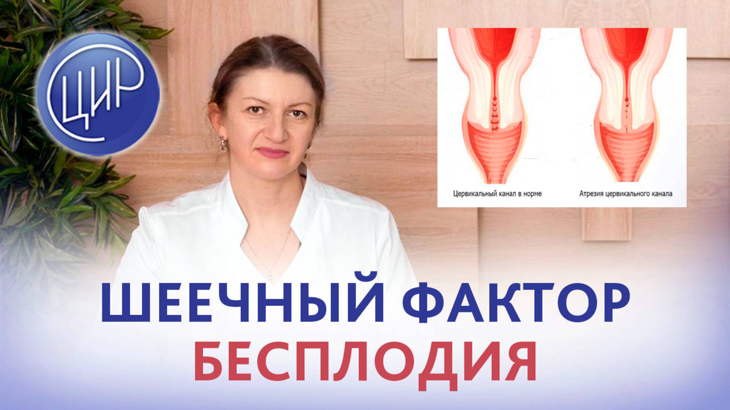 Маточный фактор бесплодия - что это такое, шеечный фактор бесплодия. Атрезия цервикального канала.