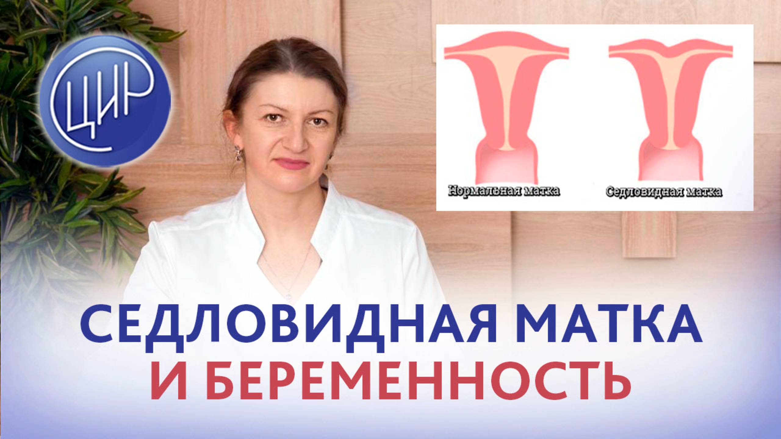 Седловидная матка: причины развития аномалии и влияние на наступление и невынашивание беременности.