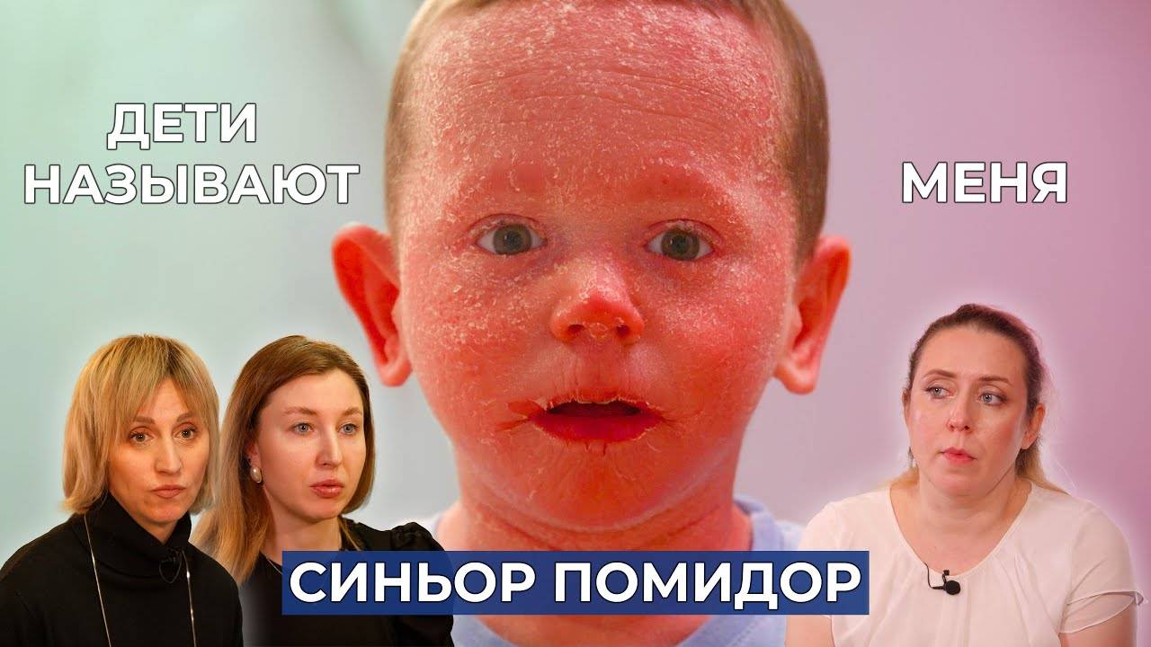 СИНДРОМ НЕТЕРТОНА | История Артёма Велижанина