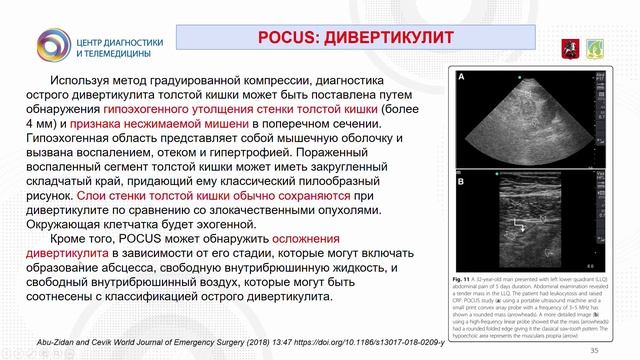 Ультразвуковая диагностика неотложных заболеваний кишечника