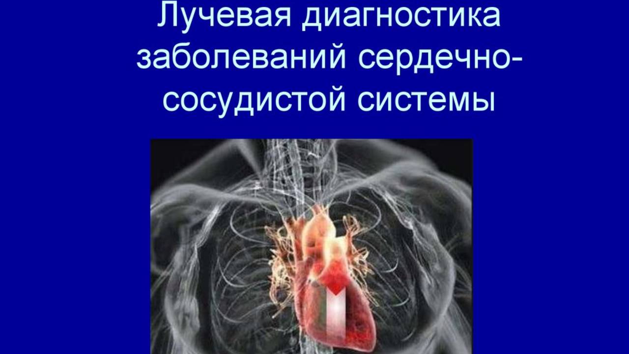 Лучевая диагностика заболевания сердца и крупных сосудов