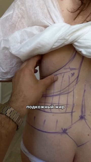 Можно ли из такого выпирающего живота сделать плоский животик?