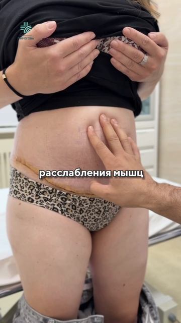 Когда одно «ПОСЛЕ» полностью меняет фигуру — смотрите до конца! 🔥
