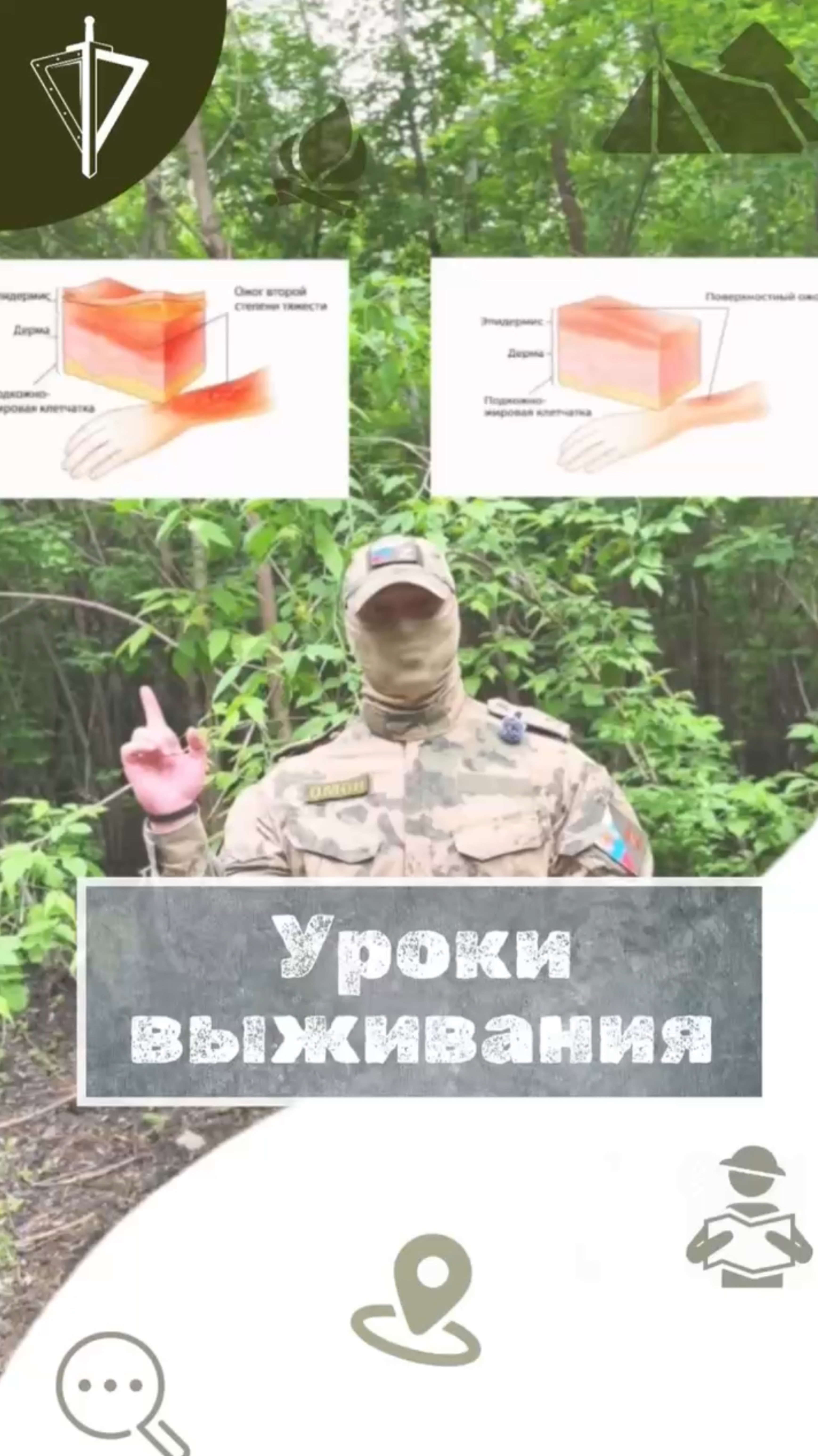 #УрокиВыживания | Помощь при термических ожогах
