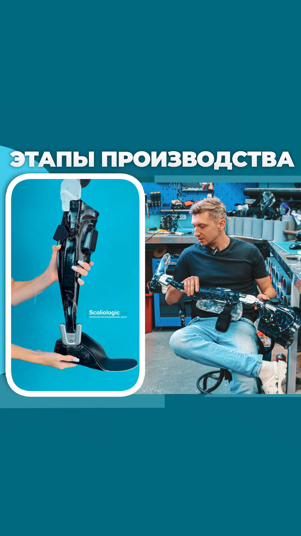 Как делается ортез с микропроцессором