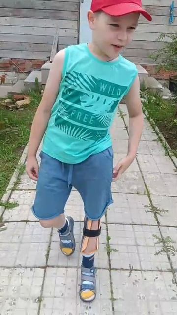 Костя ходит на кибер ноге