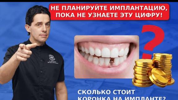 Не планируйте имплантацию, пока не узнаете, сколько стоит коронка!