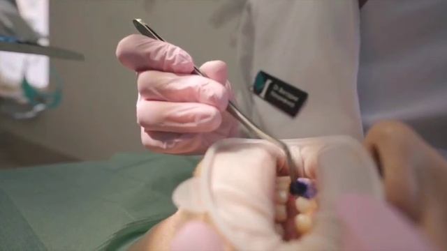 GBT протокол в стоматологической клинике «Белая Мята»