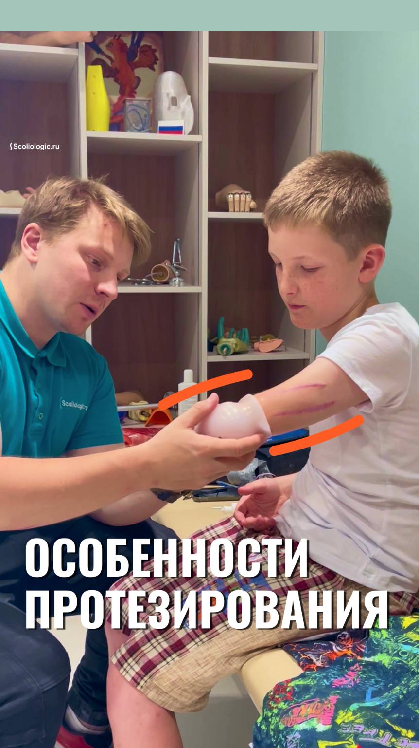 Как Грише подбирали первый протез