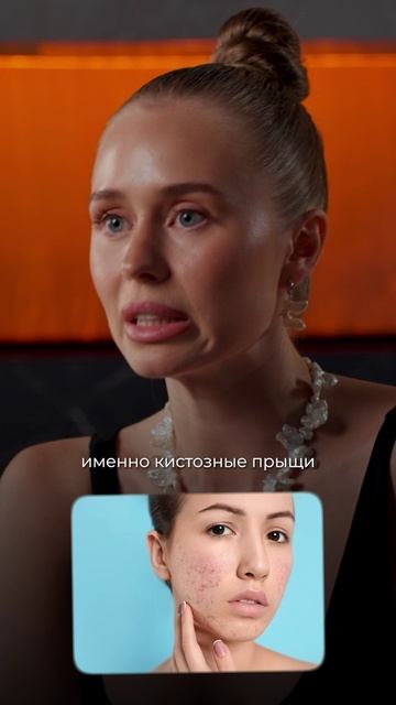 Что происходит с кожей, если выдавить прыщ?