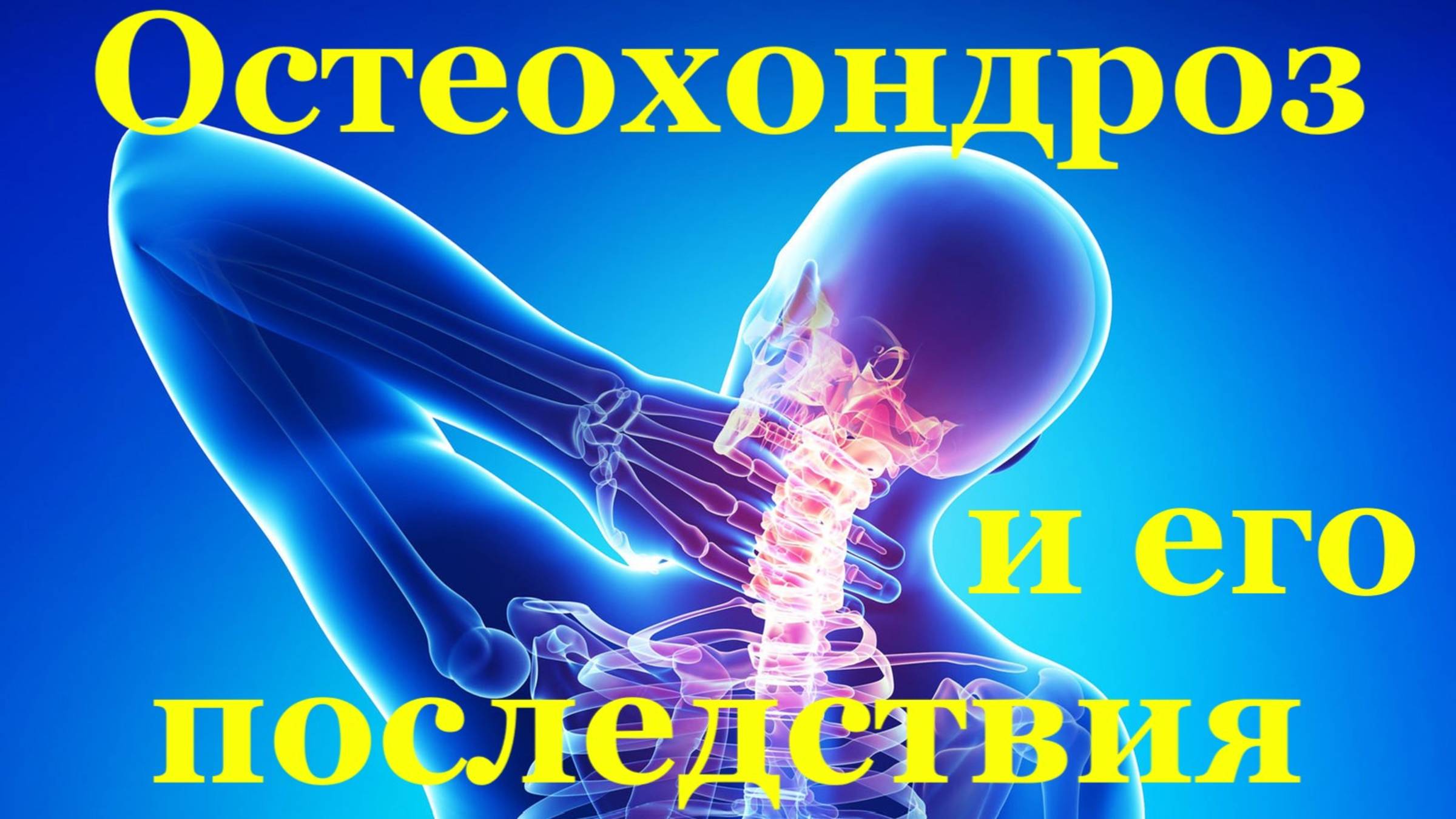 Остеохондроз и его последствия для современного человека Здоровье