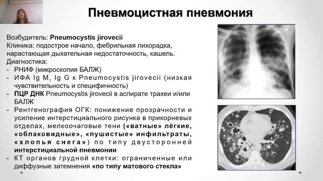 ВИЧ-инфекция. Клиническая классификация. Диагностика. Лечение