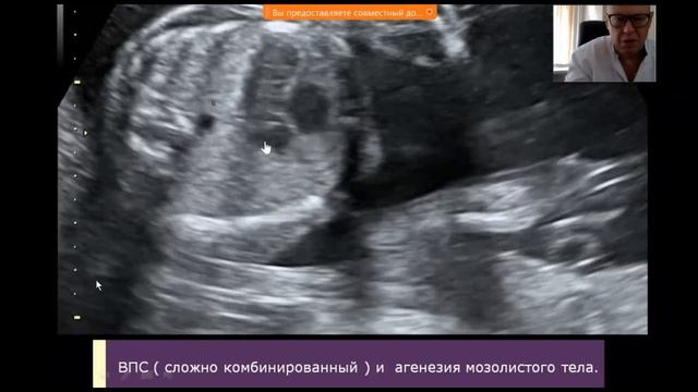 18092025. УЗИ акушерство и гинекология. Маммография