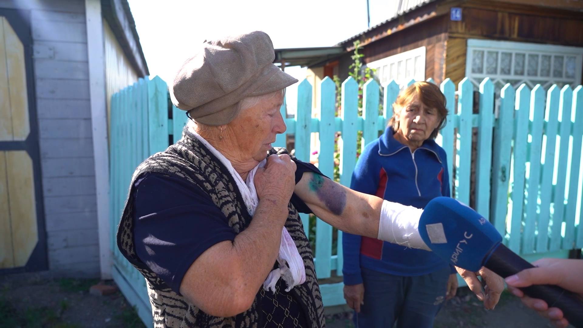 «Я уже боли не чувствовала»: пенсионерка из Бурятии рассказала, как на нее набросилась собака