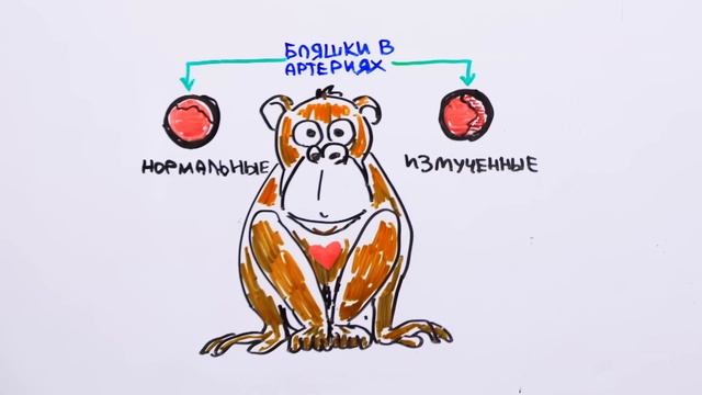 Научпок - Может ли стресс убить человека