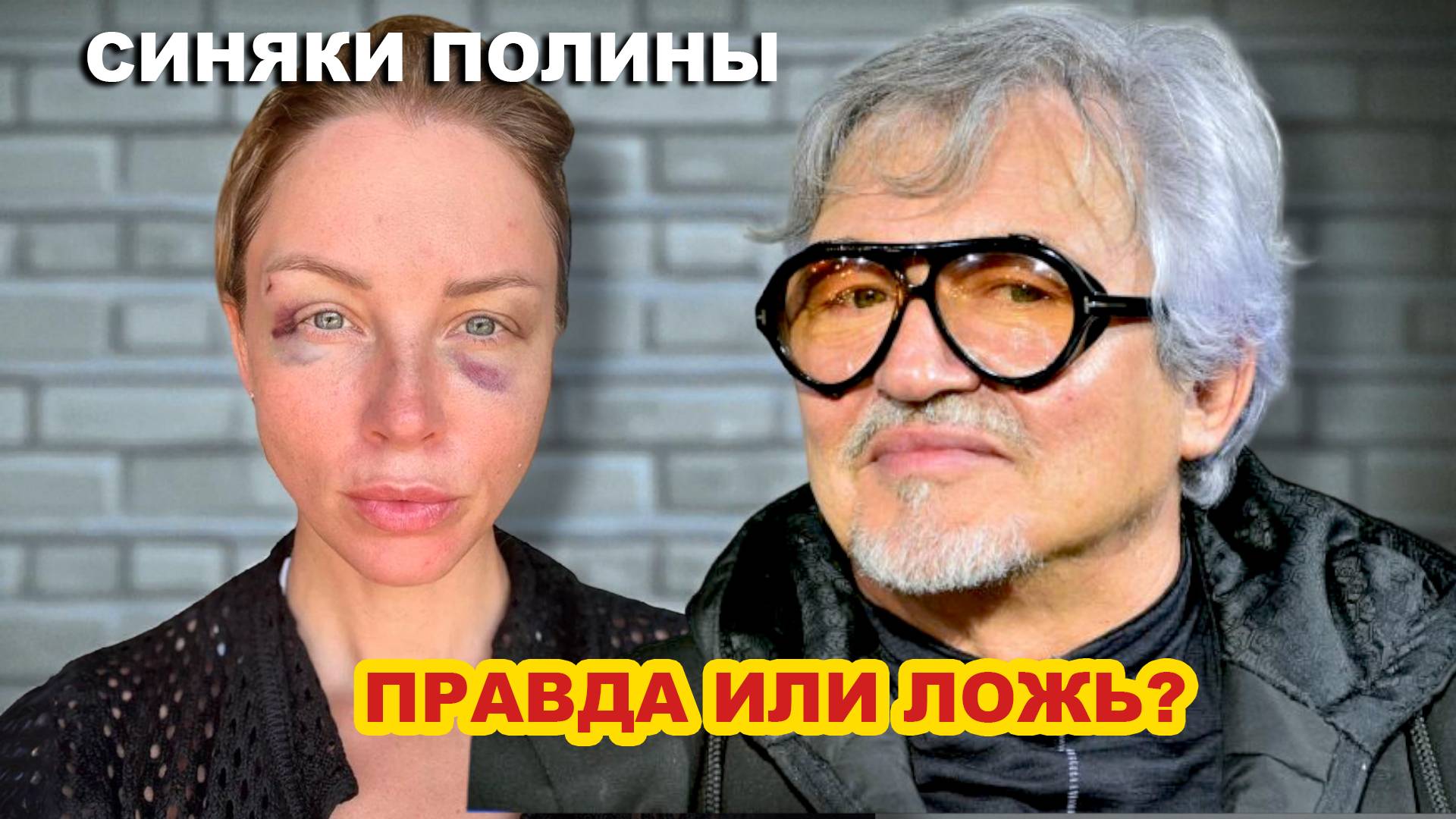 Полина Диброва В СЛЕЗАХ у Малахова показала СИНЯКИ. ПРАВДА или СПЕКТАКЛЬ? Эксперты РАЗОБЛАЧИЛИ тайну