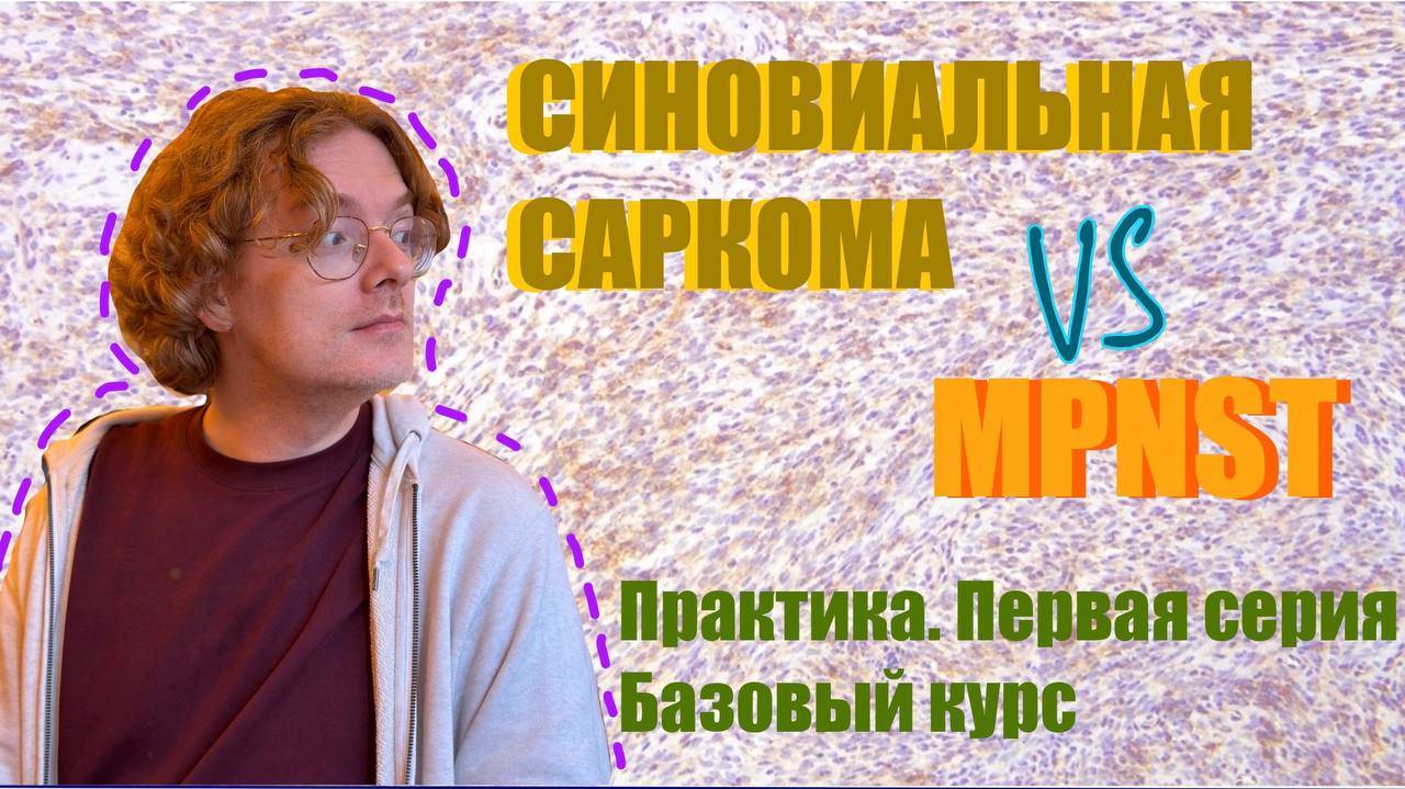 СИНОВИАЛЬНАЯ САРКОМА vs MPNST // Практика 1 серия // Базовый курс