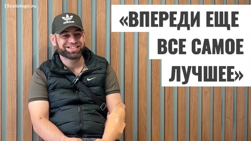 Протез руки для папы 3 детей