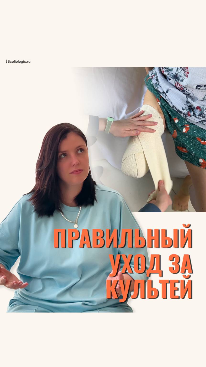 Уход за культей