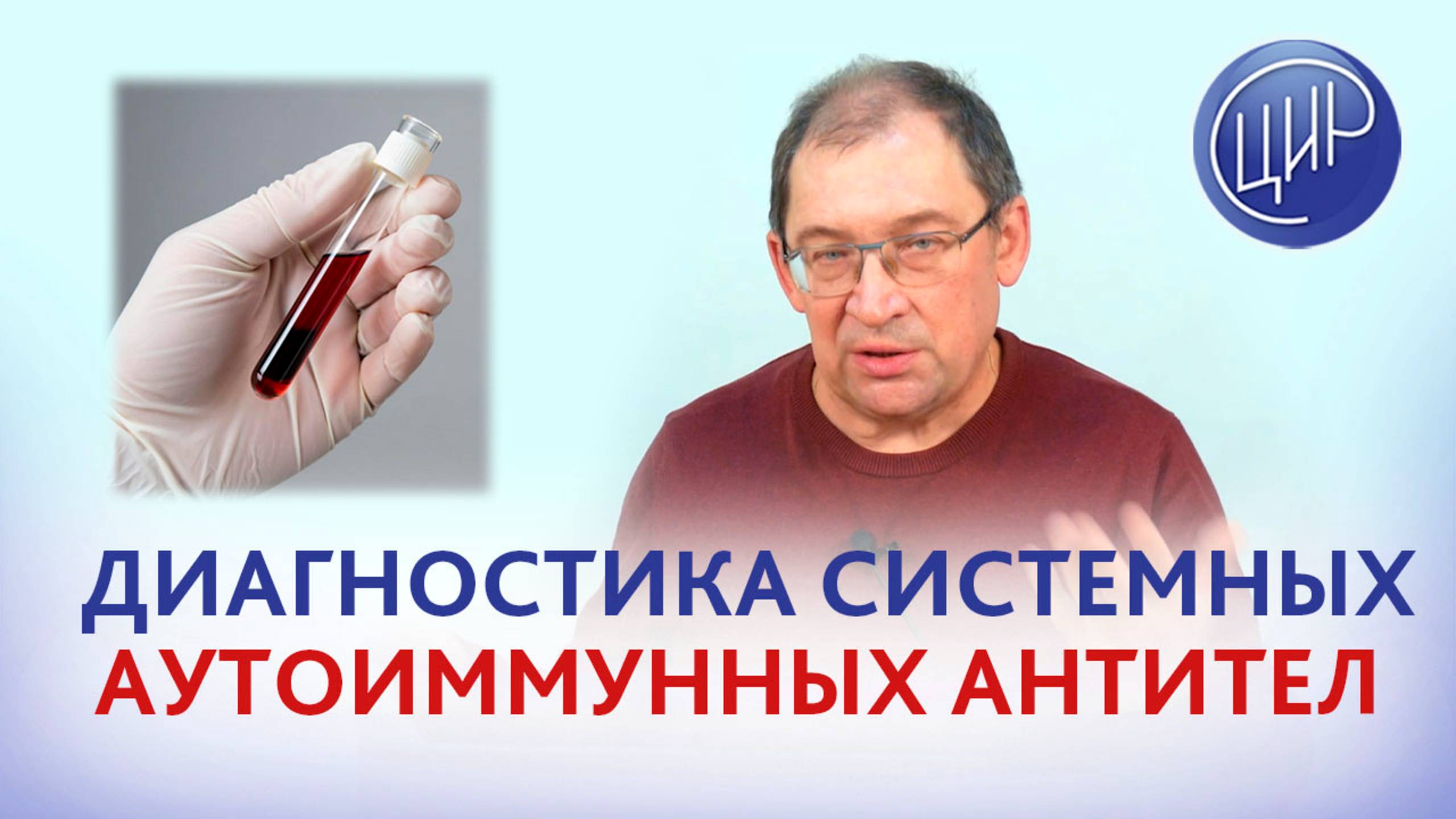 Оценка системных аутоиммунных антител в медицине репродукции. Иммуноблот на антинуклеарный фактор.