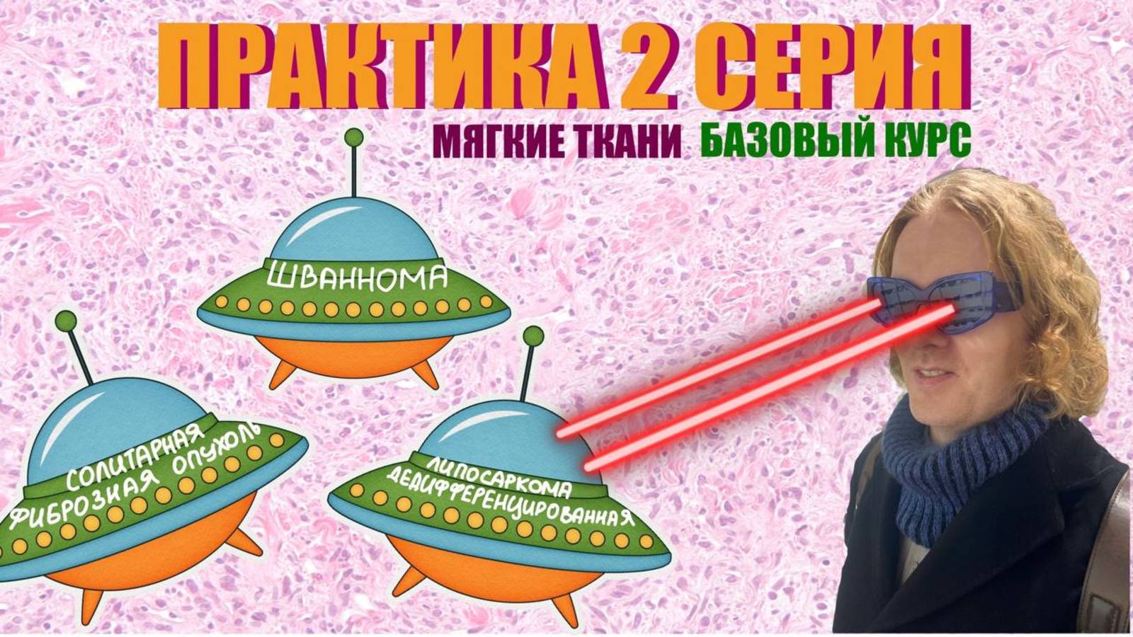 СОЛИТАРНАЯ ФИБРОЗНАЯ ОПУХОЛЬ, ШВАННОМА и кое-что еще... // Практика 2 серия // Базовый курс