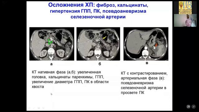 10 УЗИ и эластография