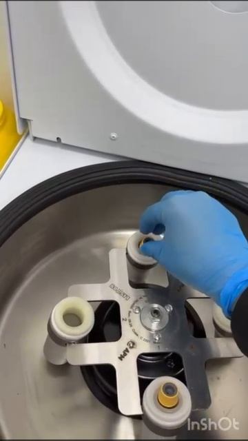 Плазмотерапия в лечении диабетической стопы