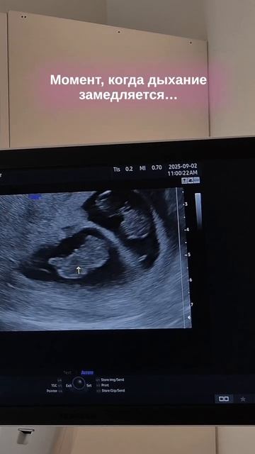 Наши пациенты знакомятся со своим малышом