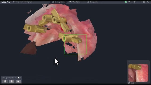 Сканирование сканбоди Pro
