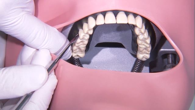 Удаление зуба (4 часть, синдесмотомия, зуб 16)