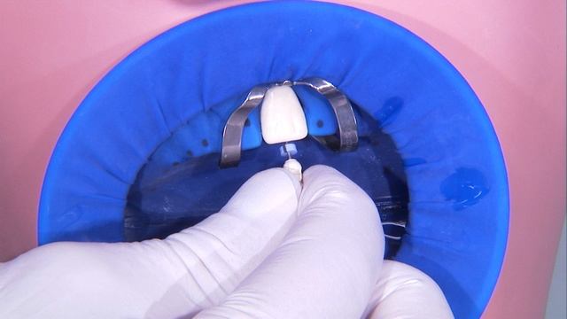 Эндодонтия (2 часть, введение эндодонтического инструмента (вручную))