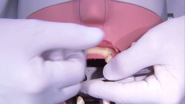 Имплантология (15 часть)