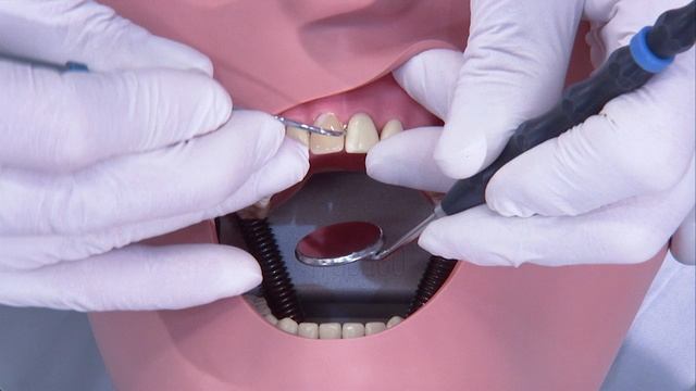 Изготовление временной коронки (13 часть, удаление лишнего)