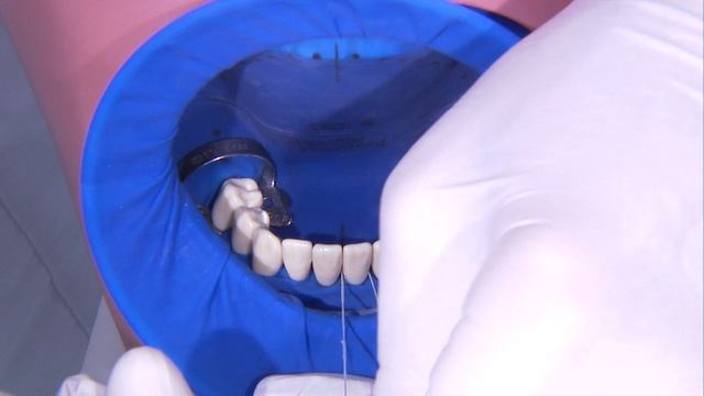 Наложение коффердама (3 часть, закрепление коффердама зубной нитью) Симуляция.