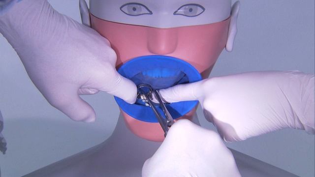 Наложение коффердама (1 часть, установка зажимов коффердама)